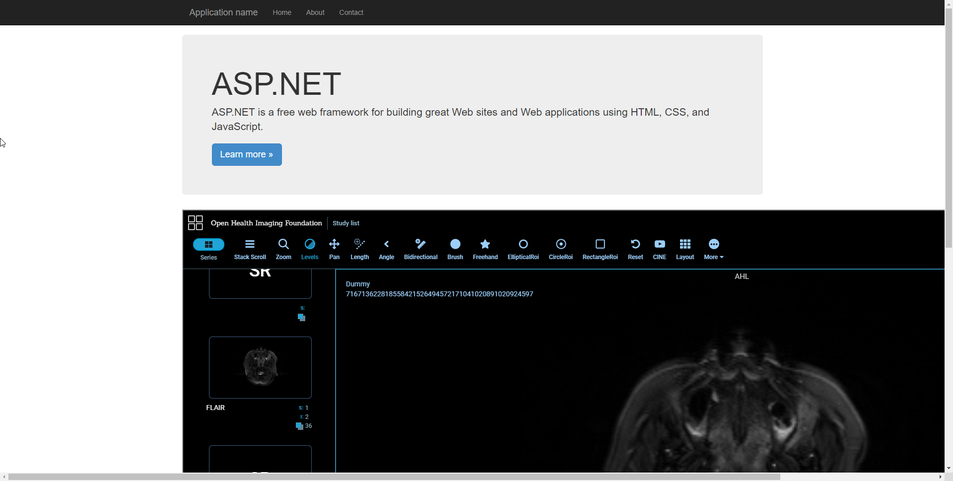 Embedding the OHIF Viewer in existing ASP.NET Web application · Issue #480 · OHIF/Viewers · GitHub