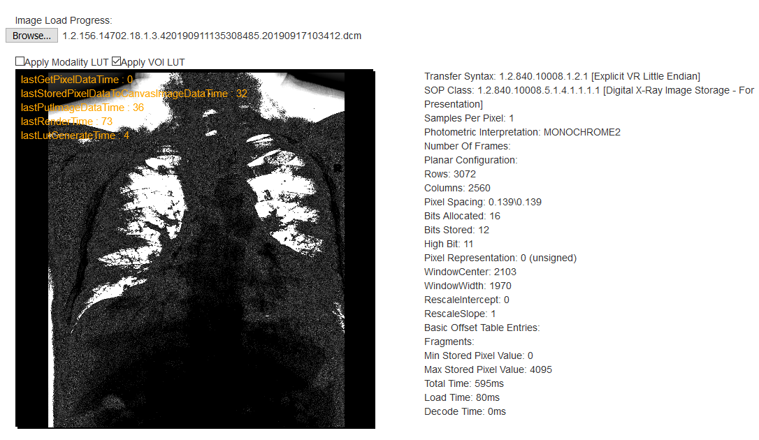 this image is abnormal · Issue #421 · cornerstonejs/cornerstone · GitHub