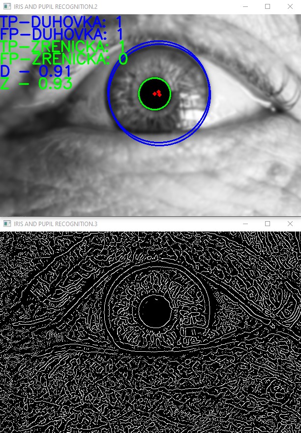 GitHub - xdurfina/iris-and-pupil-image-recognition-with-ui: In this ...