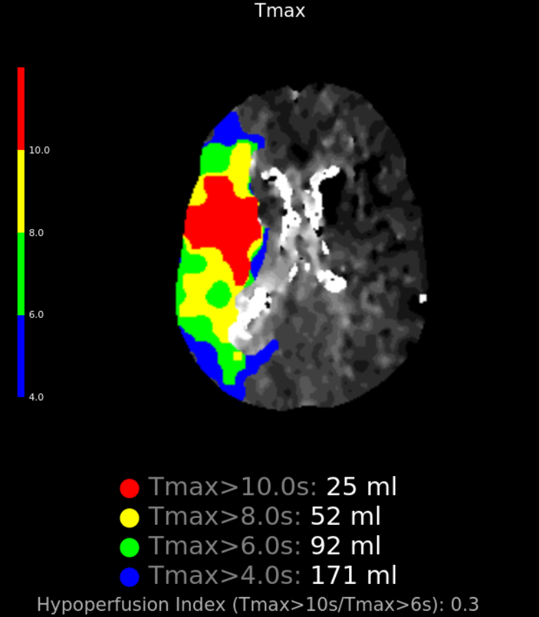 GitHub - naterex23/RAPID_Perfusion_Processing · GitHub