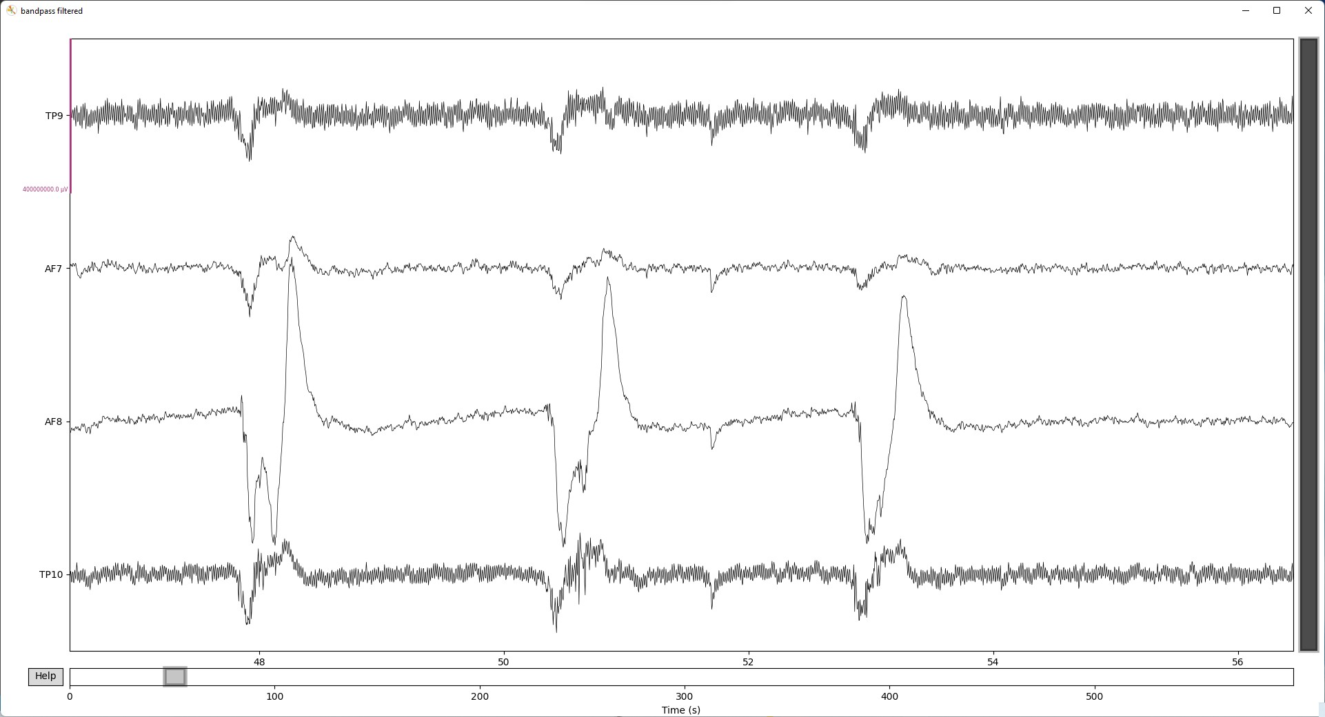 GitHub - blank-ngnl/Eye_Movement_Detection