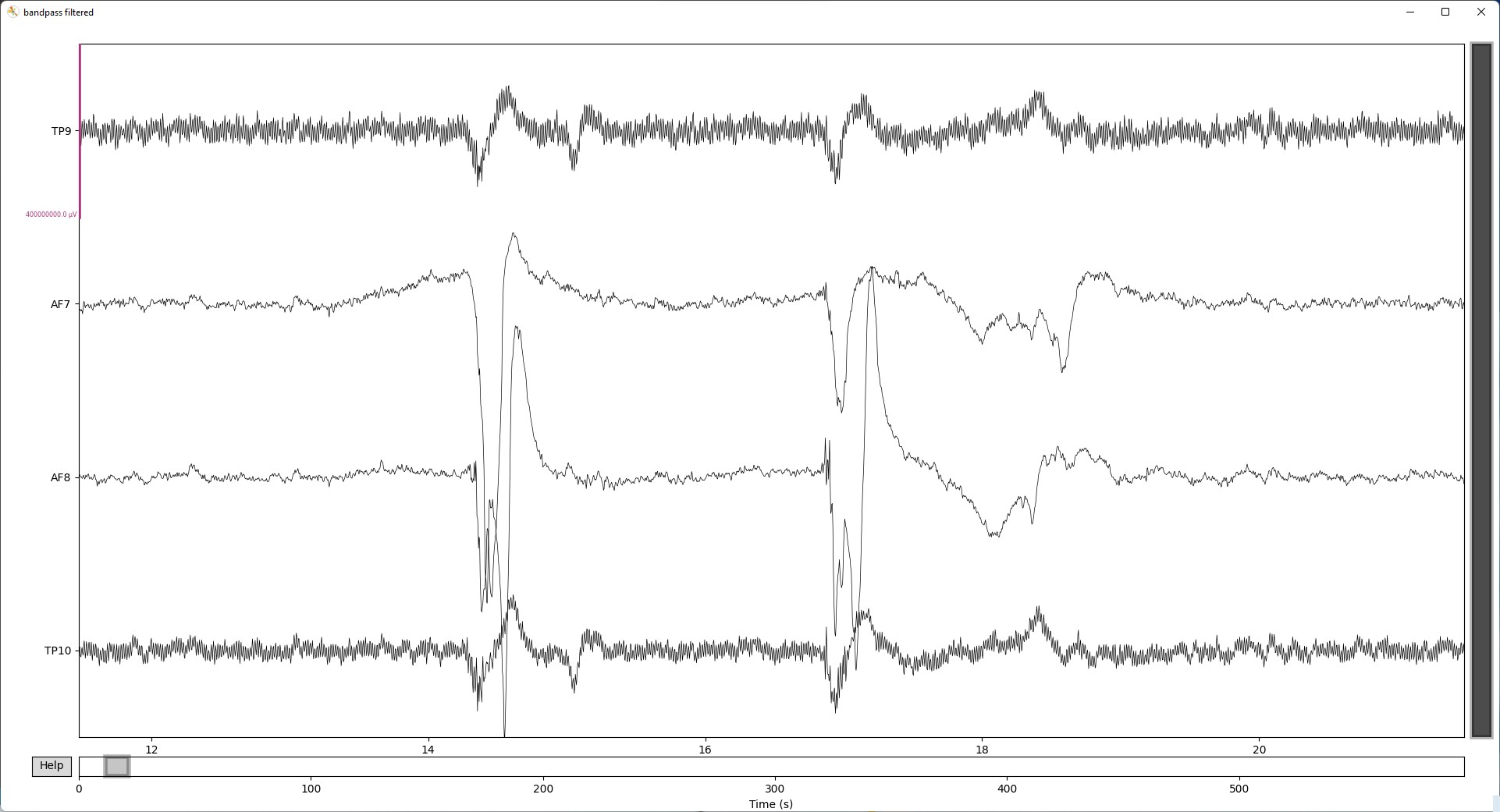 GitHub - blank-ngnl/Eye_Movement_Detection