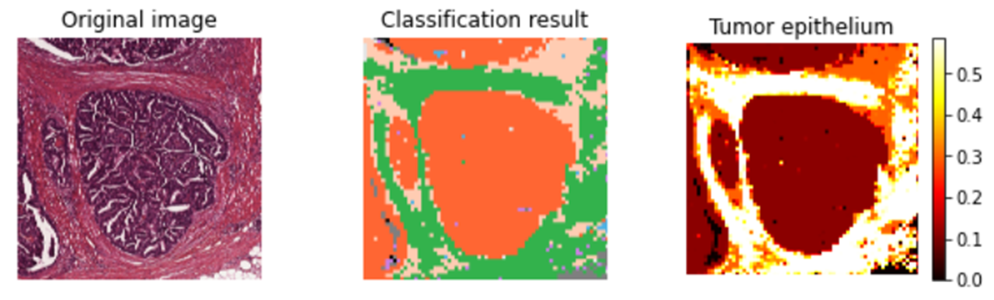 GitHub - GayaGorodecki/ColorectalHistologyClassification__Python ...
