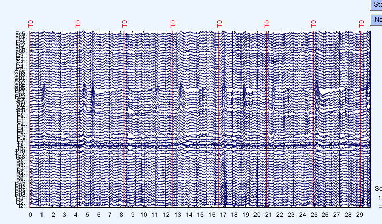 Issue loading EDF/EDF+ files · Issue #255 · sccn/eeglab · GitHub