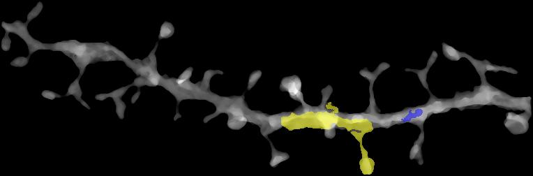 Spine detection error · Issue #2 · hvcl/SpineAnalysis_public · GitHub