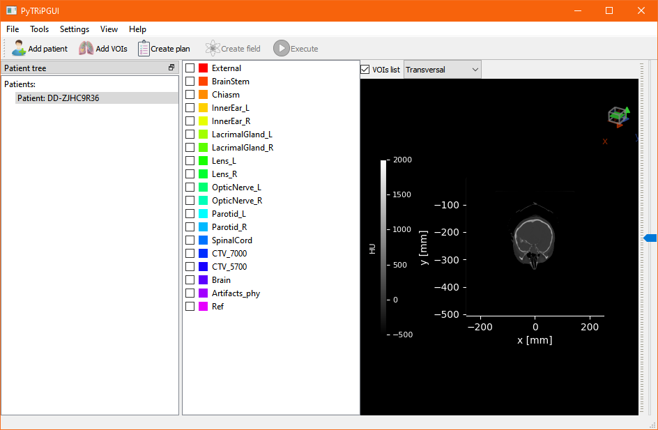 HU and Dose bar not visible with new Matplotlib · Issue #554 · pytrip/pytripgui · GitHub