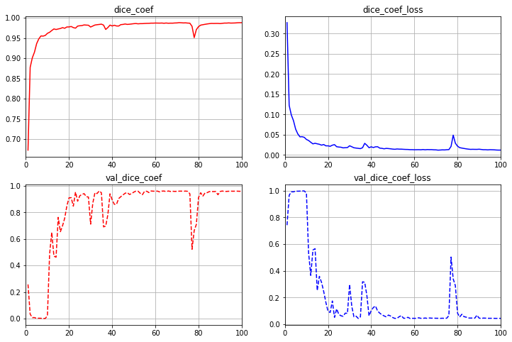 Github Shyuvi Lung Ct Segmentation Segnet Classification Of Lung