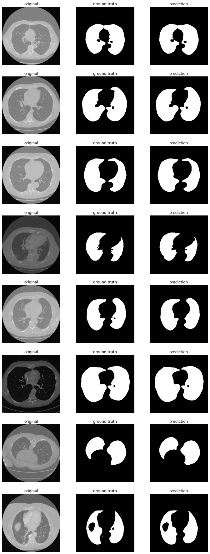 GitHub - Shyuvi/Lung_CT_Segmentation-Segnet: Classification of lung ...