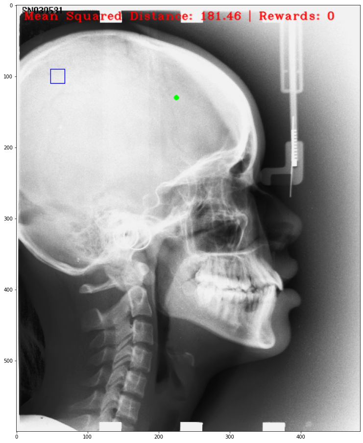 GitHub - MingzheHu-Duke/RL_Landmark_Tracking