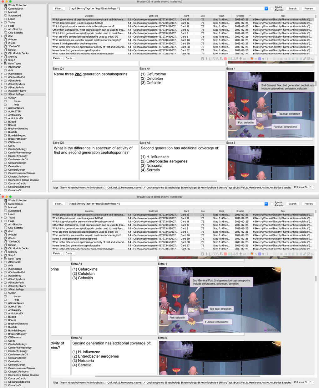Multi-Column Note Editor - Issue with image spillover : r/medicalschoolanki