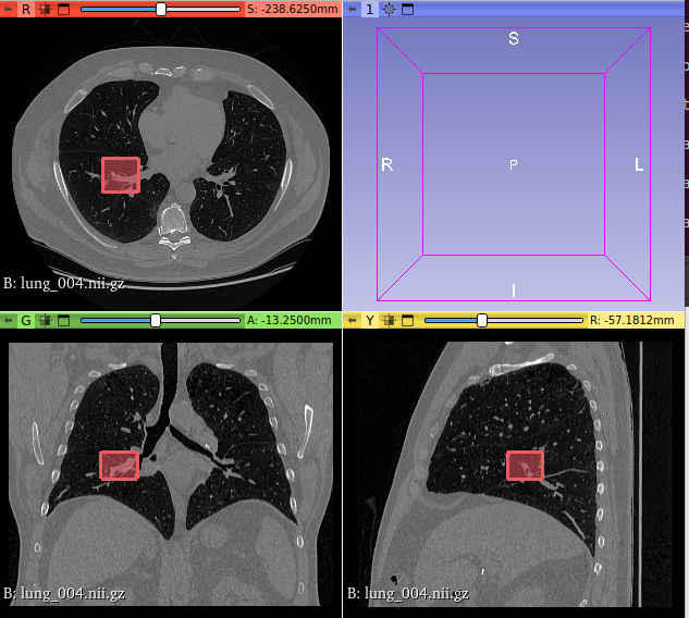 Add Detection Labeling Models Support To Slicer Infer · Issue 1087 · Project Monai Monailabel