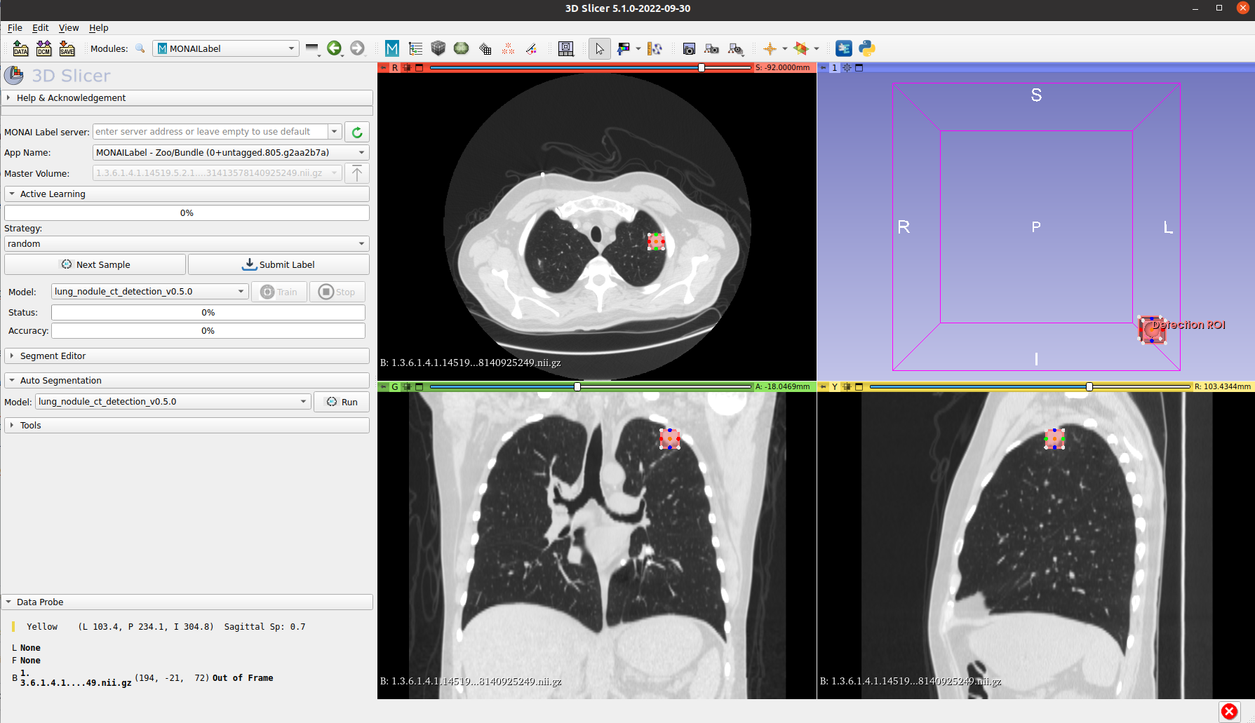 Support Detection Task Training · Issue 1184 · Project Monai Monailabel · Github