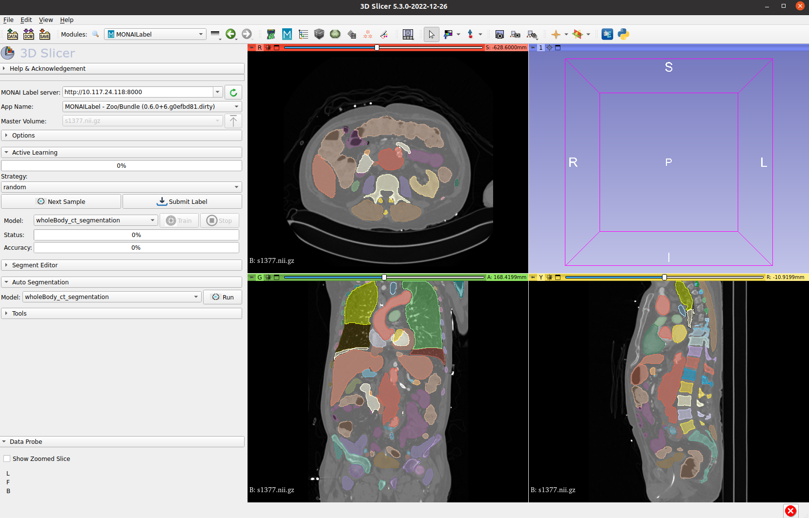 TotalSegmentator (104 organs) by MONAI team | MONAI Label | Bundle ...