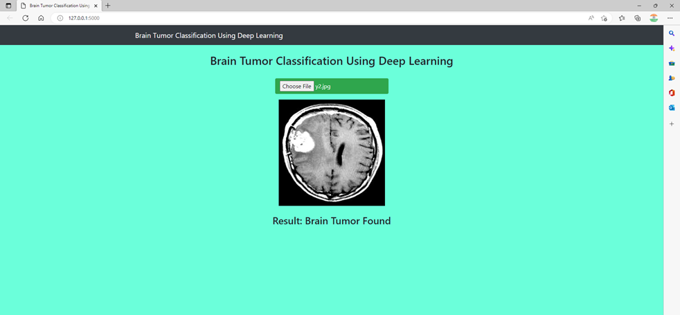 Github Sagar0107 Brain Tumor Detection
