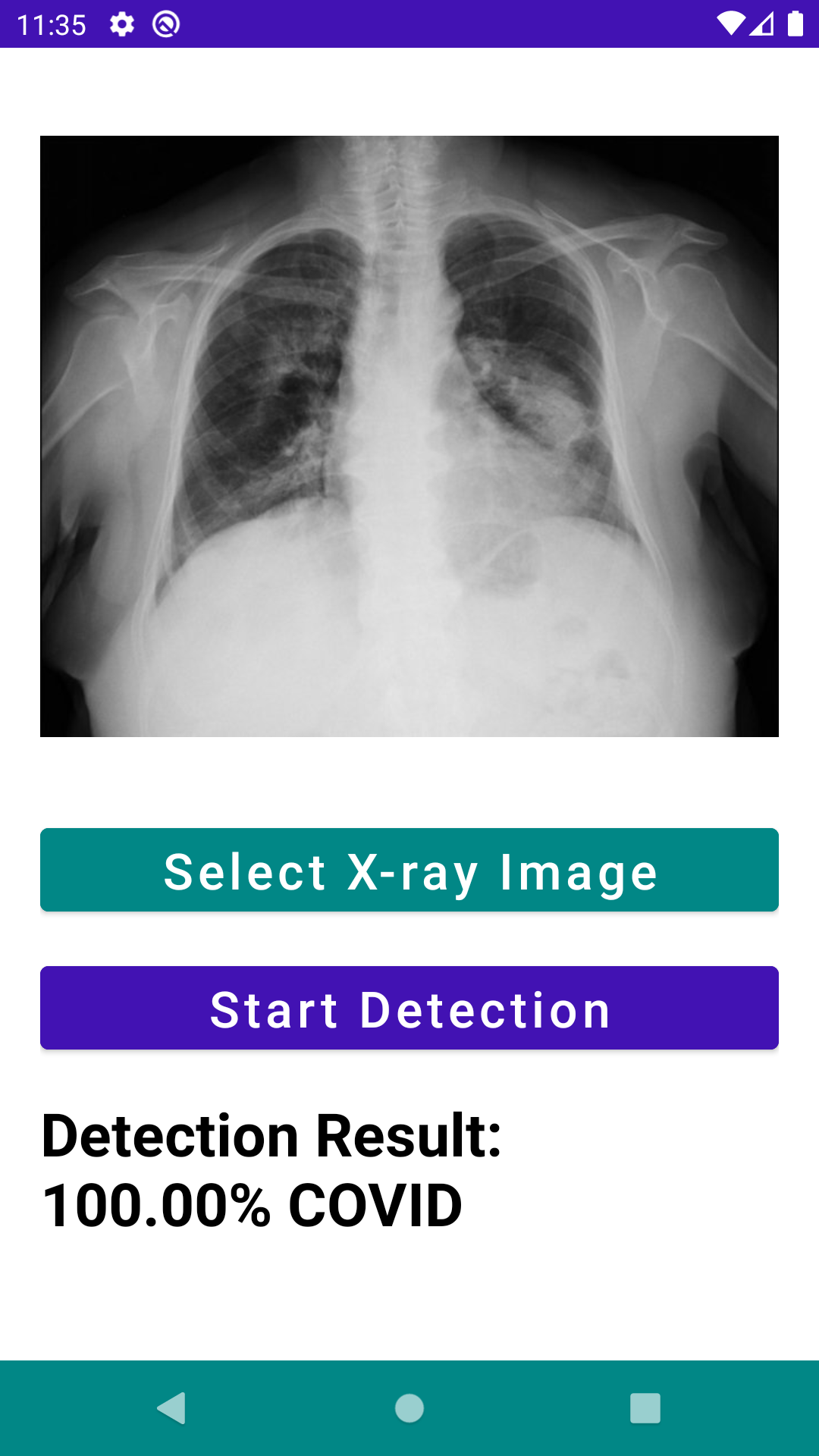 Github Abdulrhman Khaled Covid19 Detection Using Chest X Ray Using