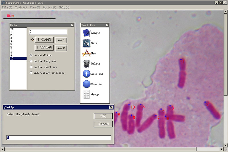 GitHub - fahimaltinordu/A-tool-for-the-analysis-of-chromosomes ...