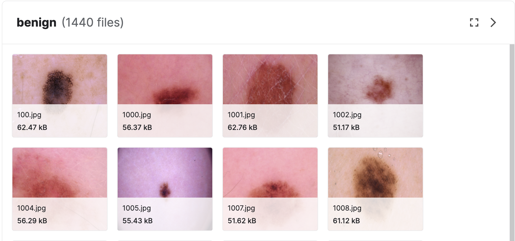 GitHub - YajatMittal/Skin-Cancer-Detection