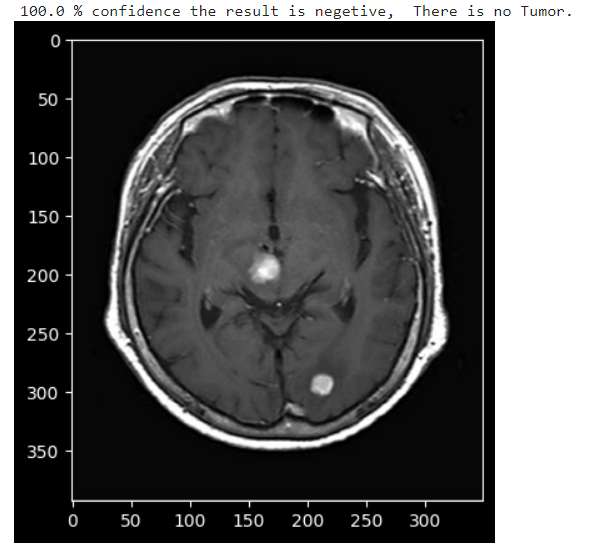 GitHub - shajon1211045/brain_tumor_prediction