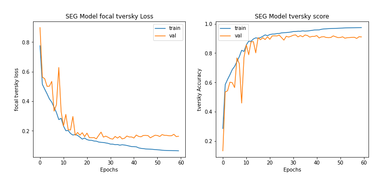 GitHub - SahinTiryaki/Brain_tumor_segmentation_Vgg19UNet: Brain tumor ...