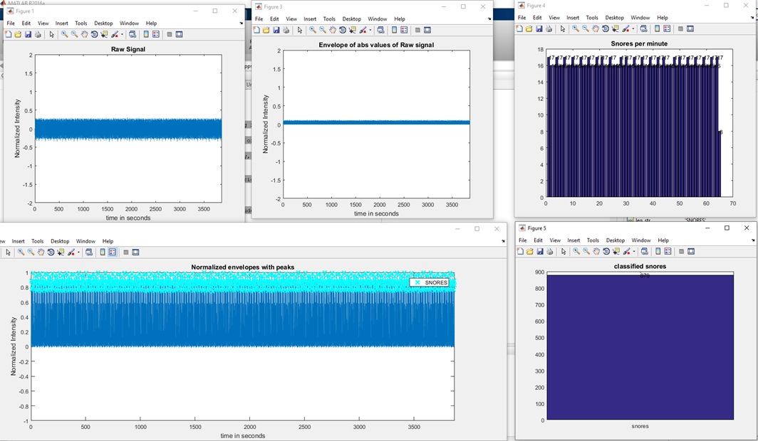 GitHub - ye-sky/Detecting-Breathing-and-Snoring-with-Matlab