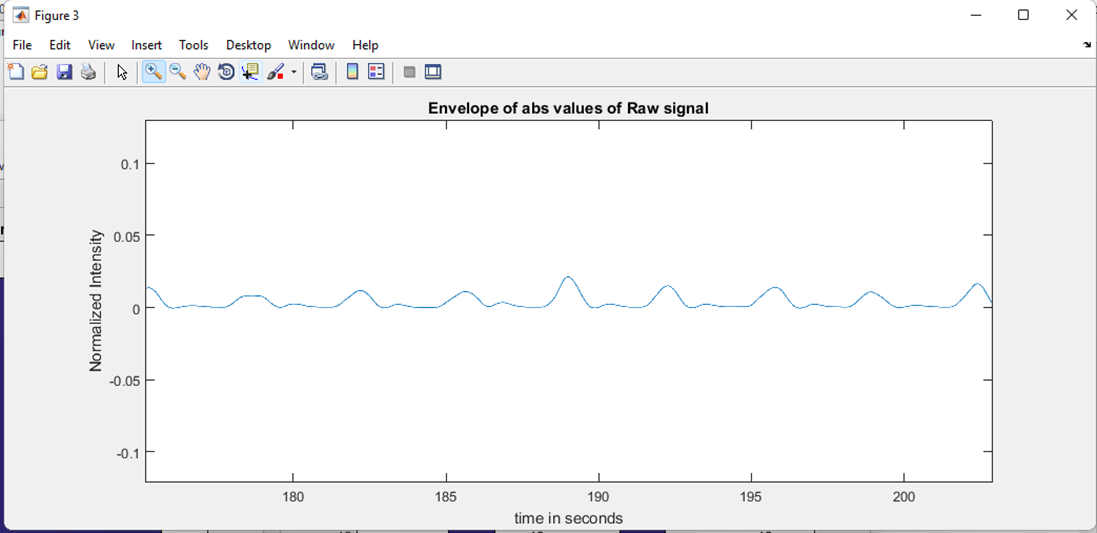 GitHub - ye-sky/Detecting-Breathing-and-Snoring-with-Matlab