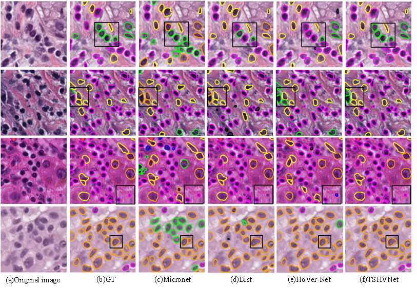 GitHub - jia-yang-b/TSHVNet