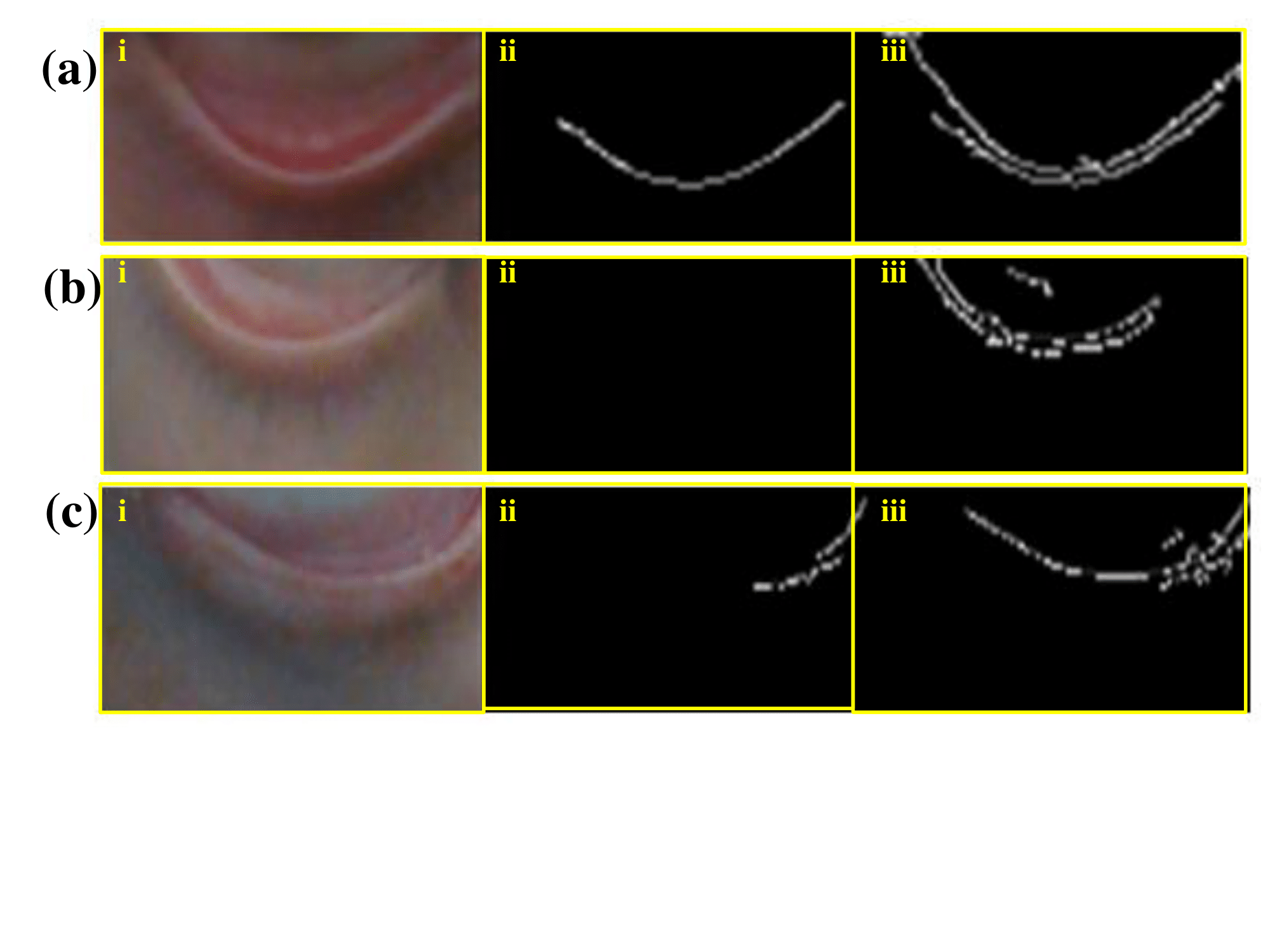 GitHub - sagnikgh1899/sHEMO
