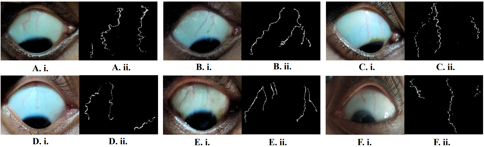 GitHub - sagnikgh1899/gluCam