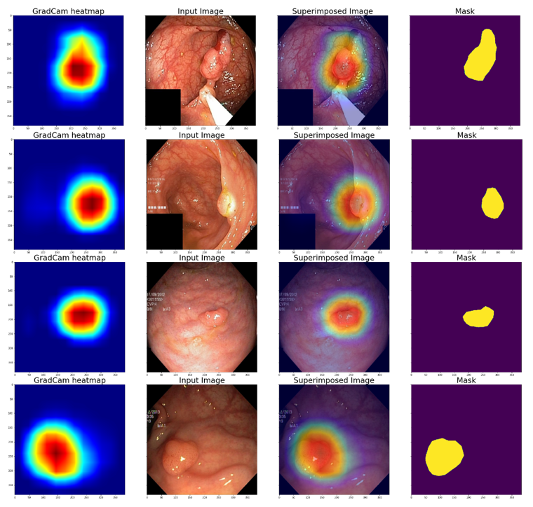 GitHub - hjm9702/Kvasir-XAI