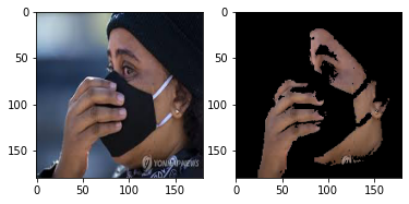 GitHub - YangChangHee/Skin_Detection_MLPs