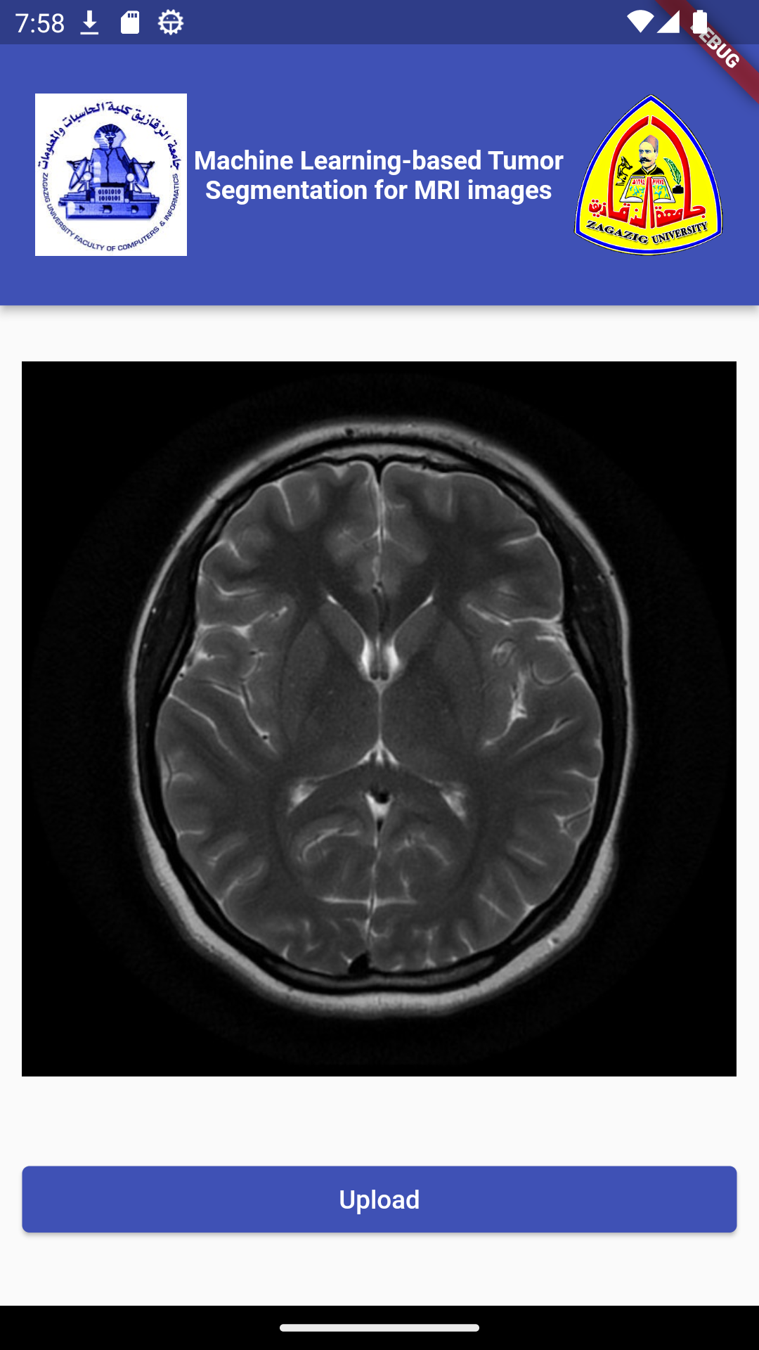 GitHub - s448/tumor_segmentation: my graduation project application for ...
