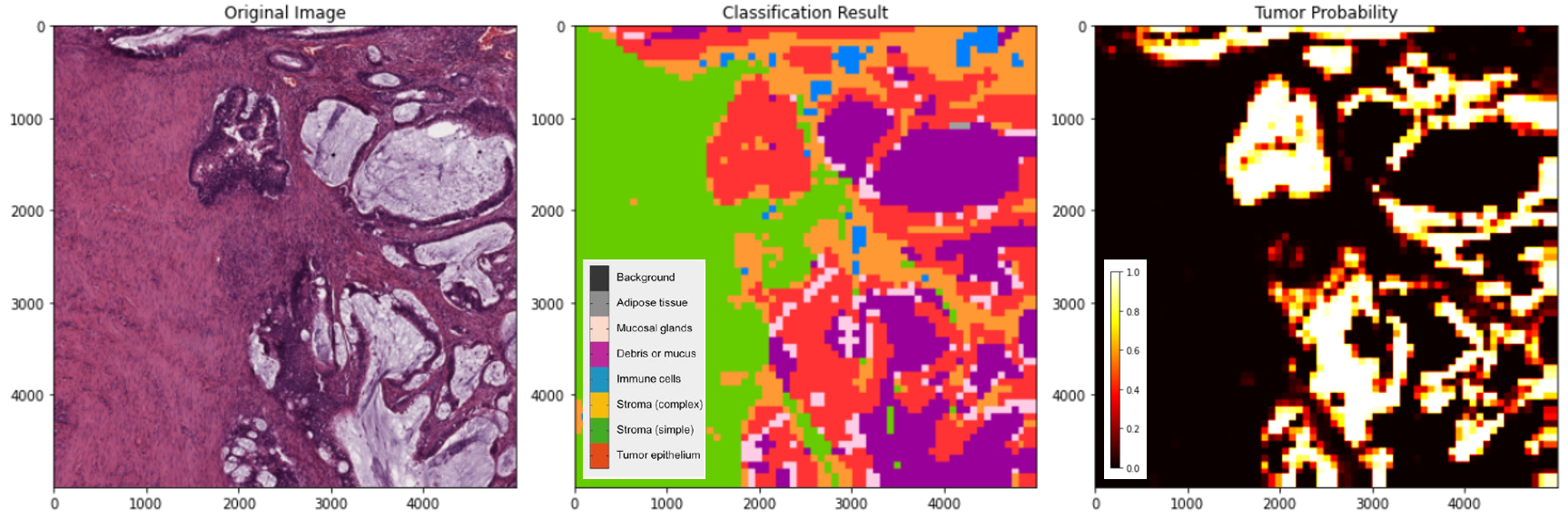 GitHub - ChenPan311/Colorectal-Histology-Classification