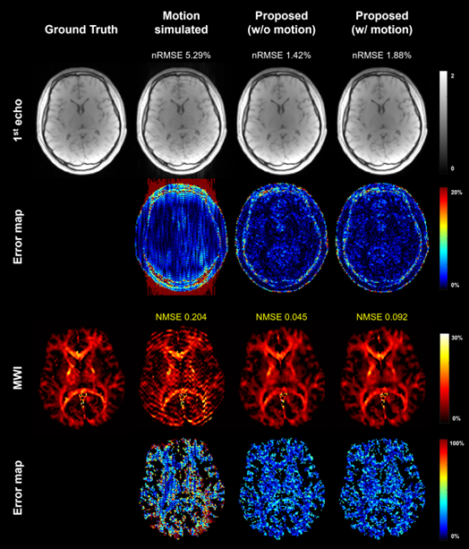 GitHub - Yonsei-MILab/JUST-Net