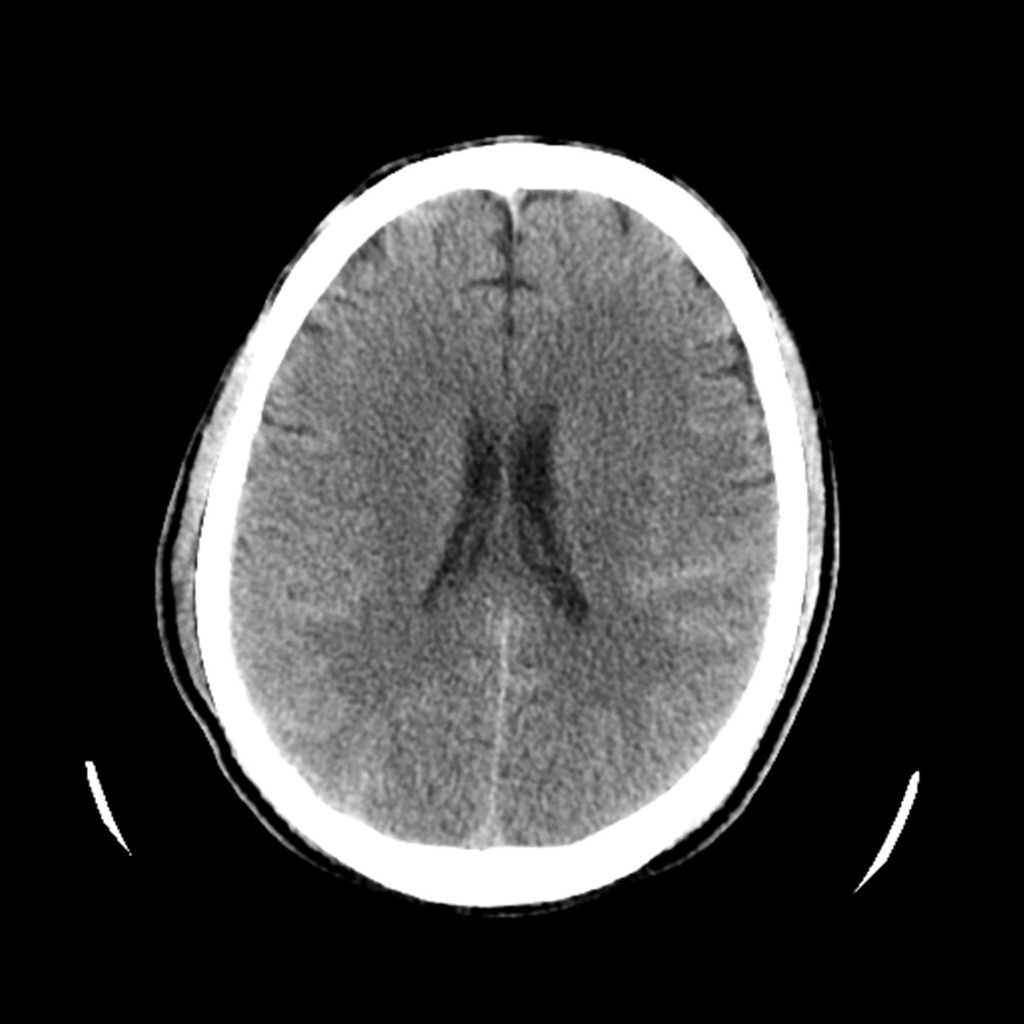 Training on 2D dataset. · Issue #8 · junyuchen245/TransMorph ...