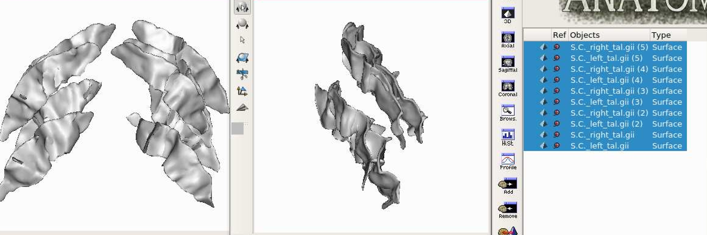 Saving the central sulcus as a mesh · brainvisa brainvisa.github.io · Discussion #50 · GitHub
