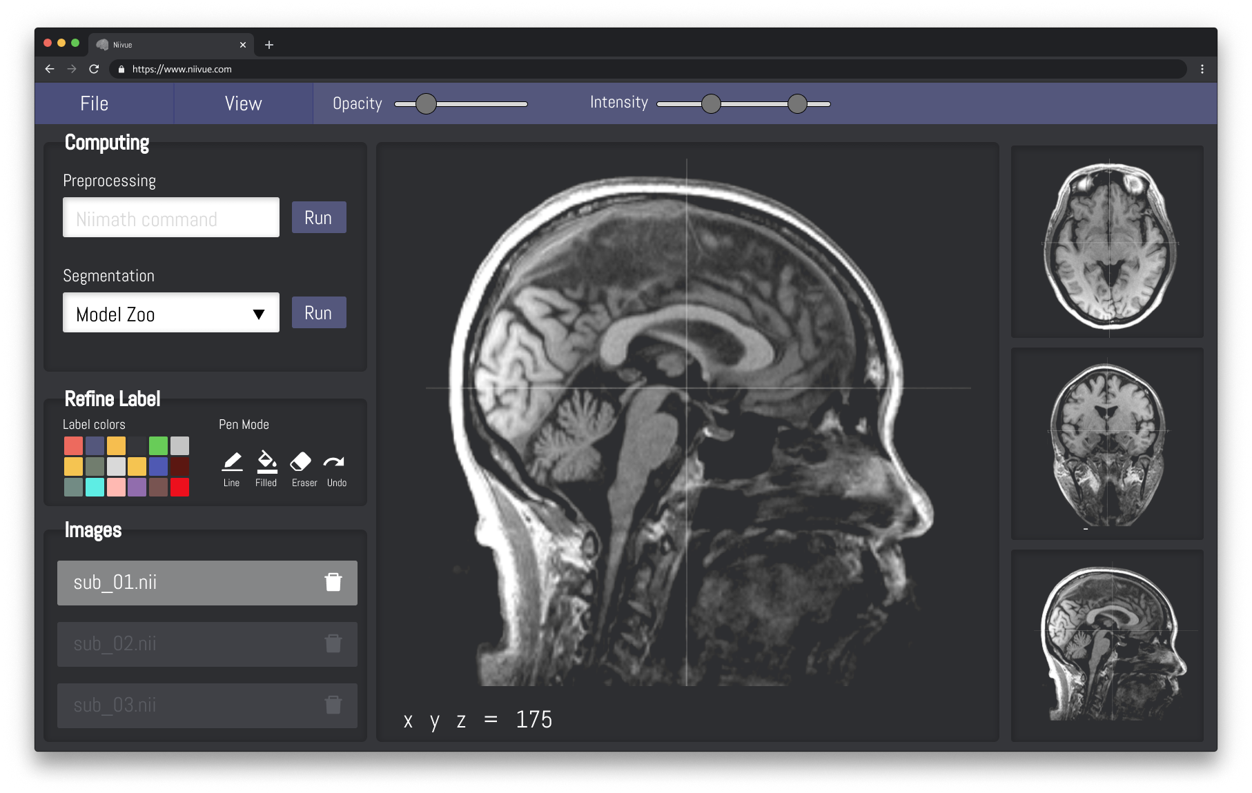 Niivue + ONNX clientside · Issue #663 · niivue/niivue · GitHub