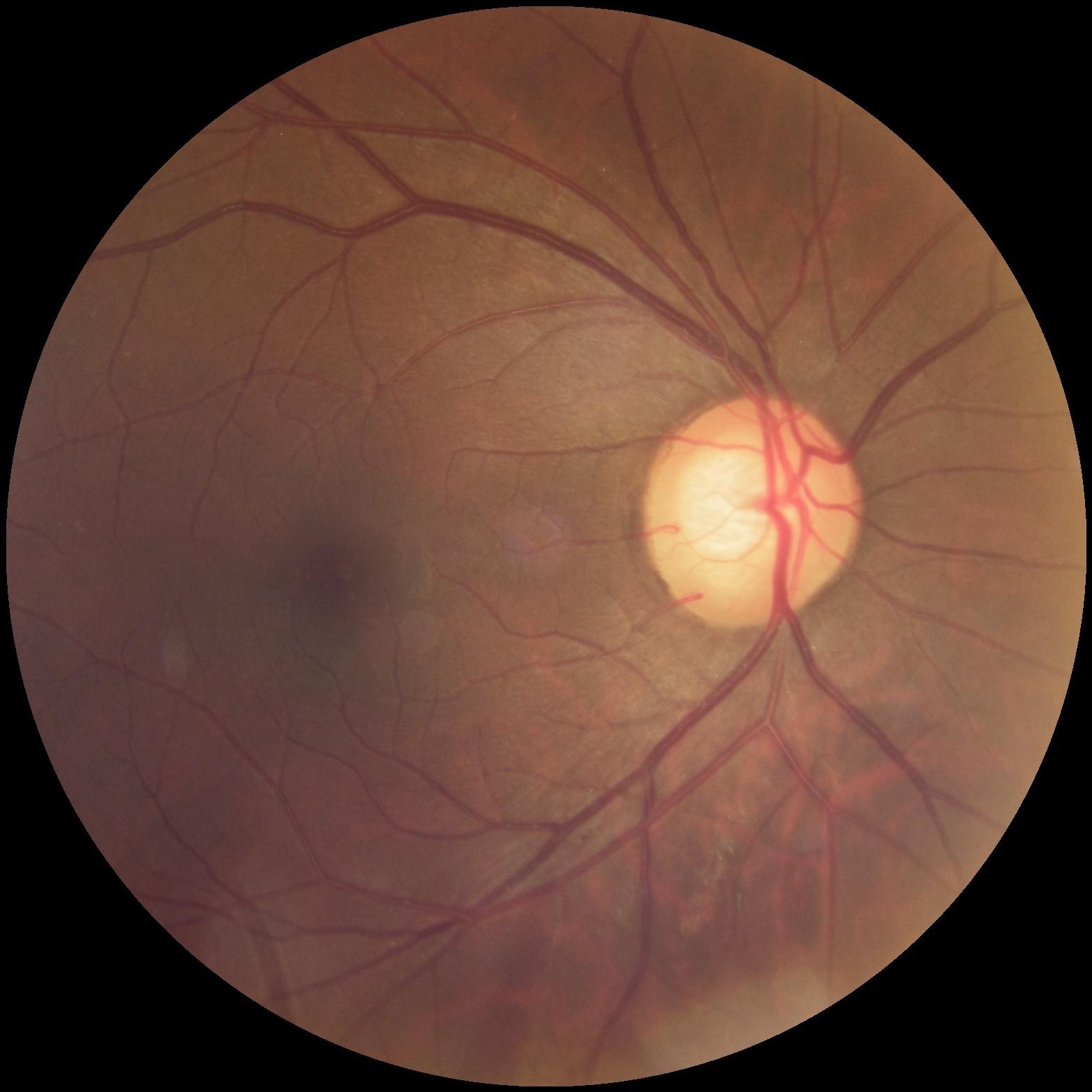 GitHub - Hannah-SWJ/Ocular-disease-classifier