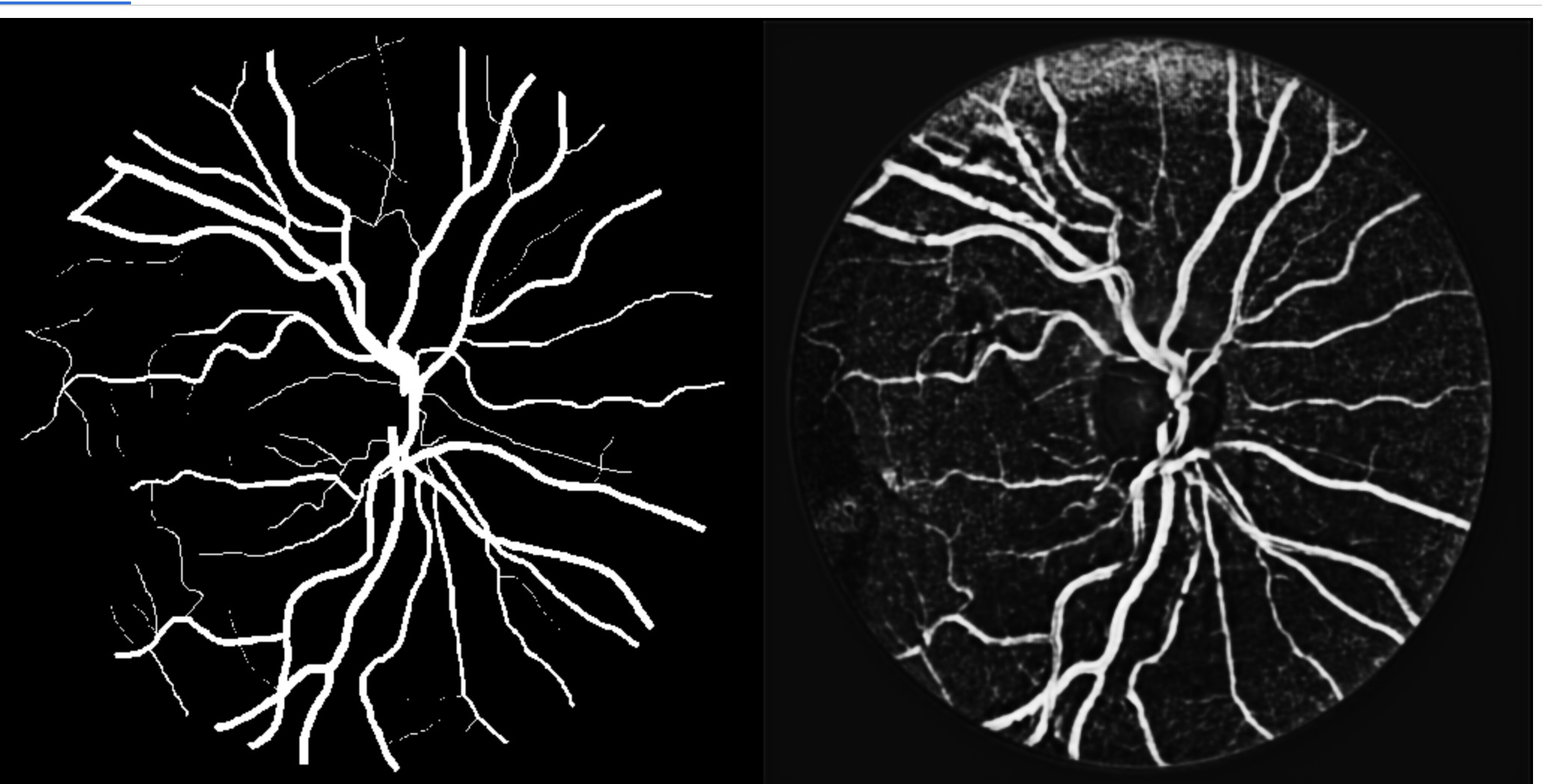 GitHub - jin-lin0/cornea: unet