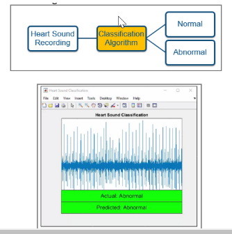 GitHub - AsiakN/heart-sound-classification: Repo for capstone project ...
