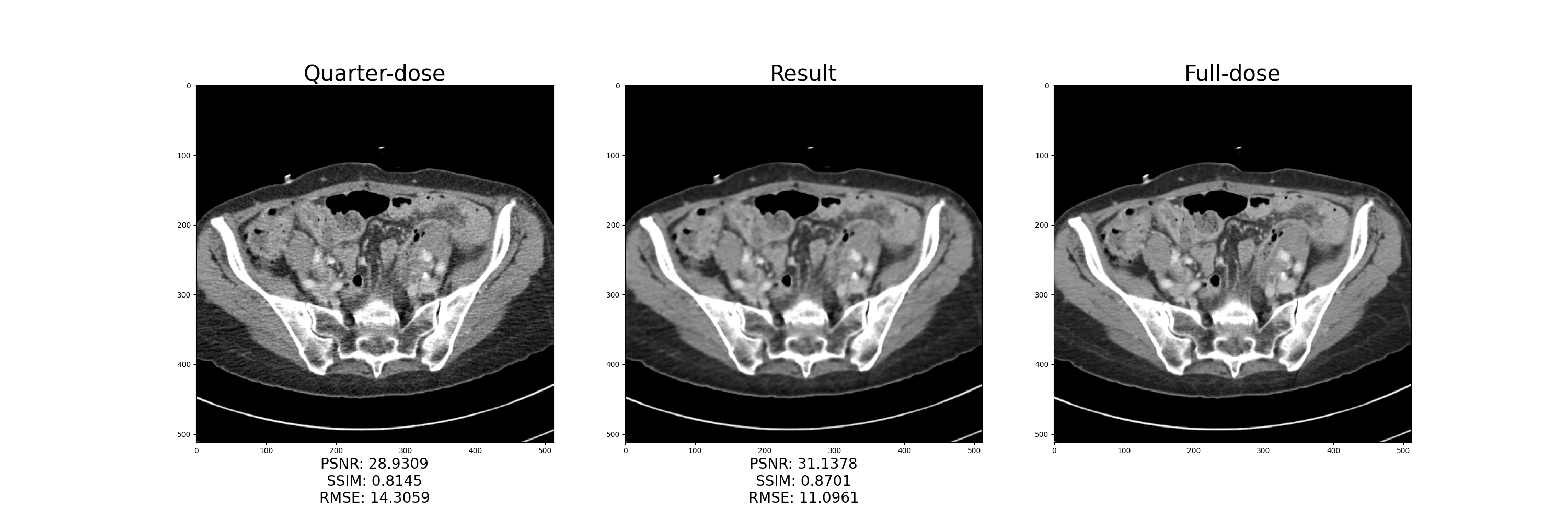 GitHub - Nhildenbrand19/RED-CNN-Project