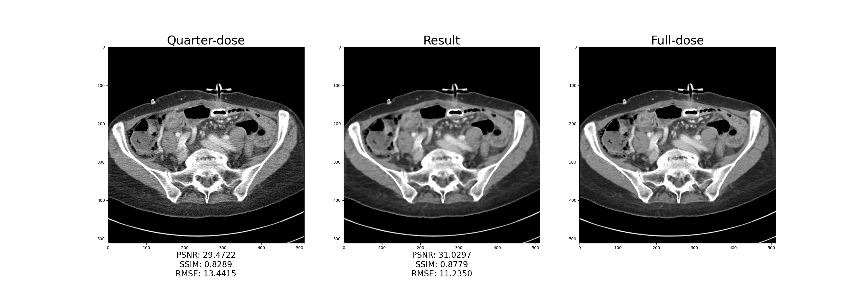 GitHub - Nhildenbrand19/RED-CNN-Project