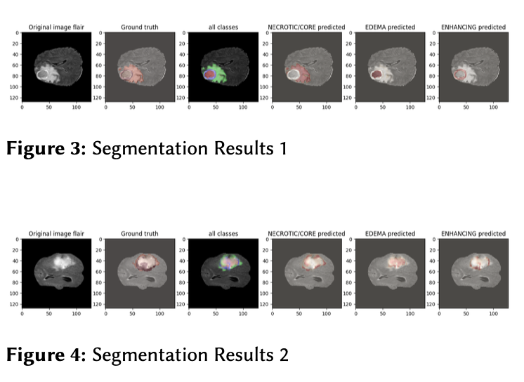 GitHub - saudhussainkhand/Interpretable-Model-For-Brain-Tumor-Segmentation-xAI-: This repository ...