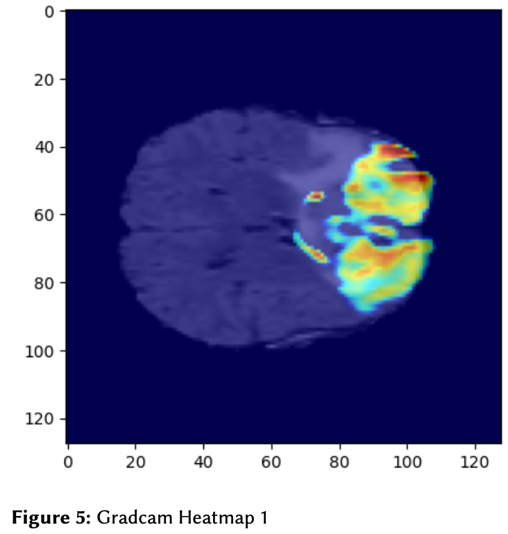 GitHub - saudhussainkhand/Interpretable-Model-For-Brain-Tumor-Segmentation-xAI-: This repository ...
