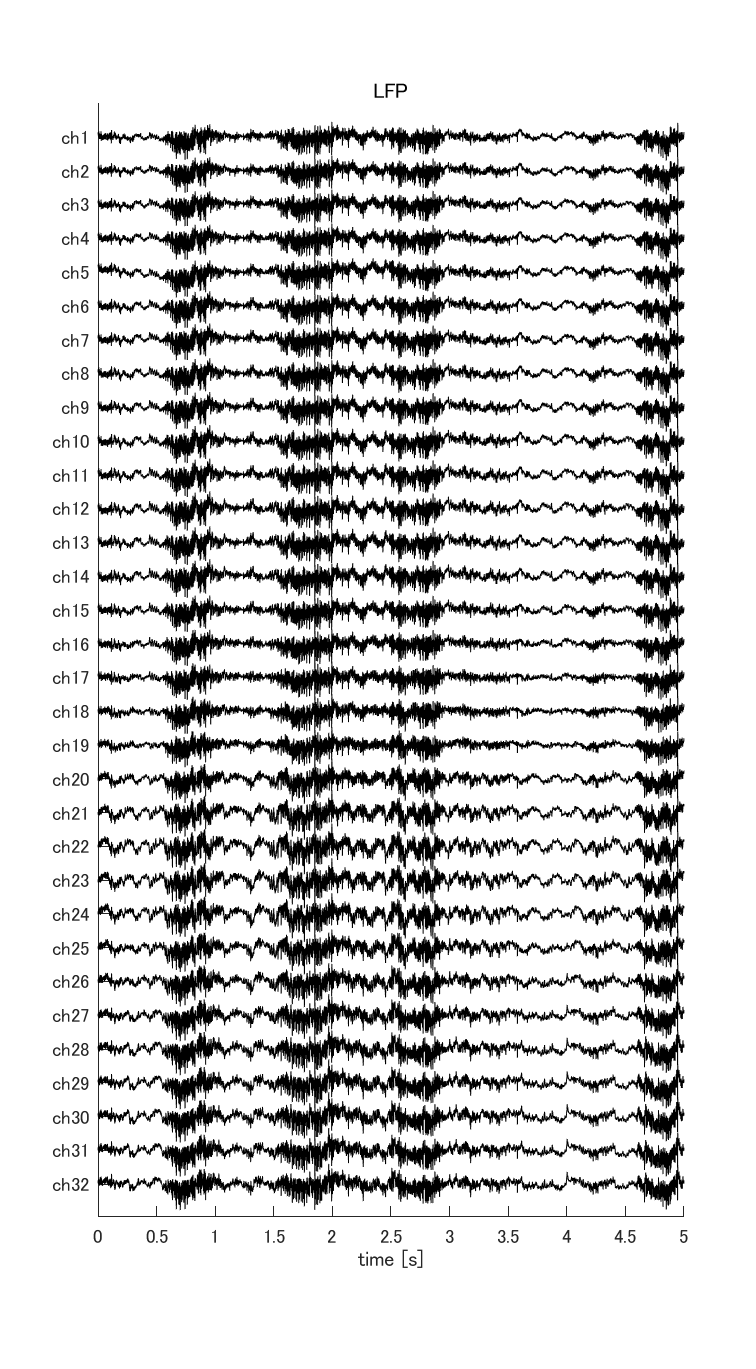 GitHub - HisayukiOsanai/IC-EMG: extract EMG signal from skull-screw ...