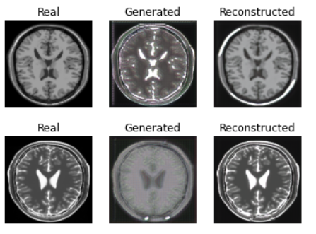Github Anuvarshini027 Cyclegan For Mri Images Github