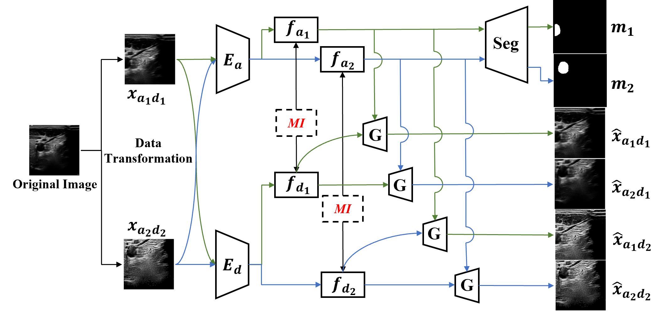 GitHub - yuan-12138/MI-SegNet
