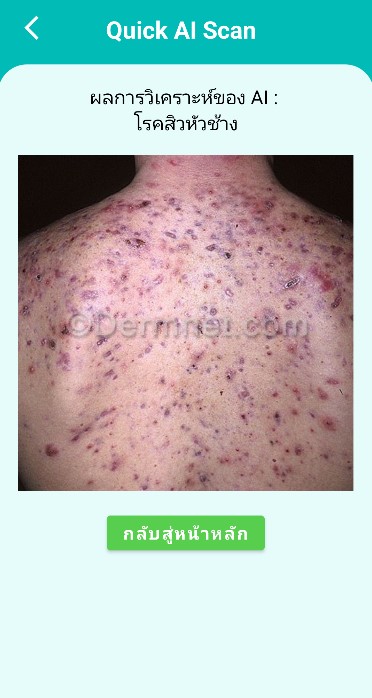 GitHub - hewgokiki/TUDerm_SkinDiseaseDetection