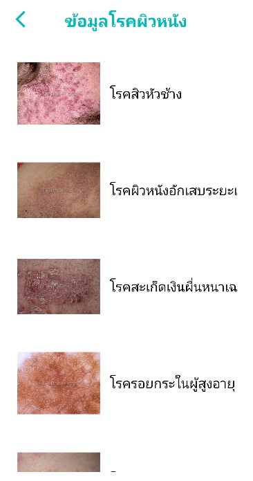 GitHub - hewgokiki/TUDerm_SkinDiseaseDetection