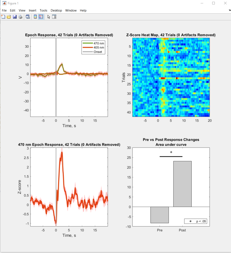 GitHub - khairunisa-ibrahim/Ibrahim-Massaly-2023: Codes used for "Dorsal Hippocampus To Nucleus ...