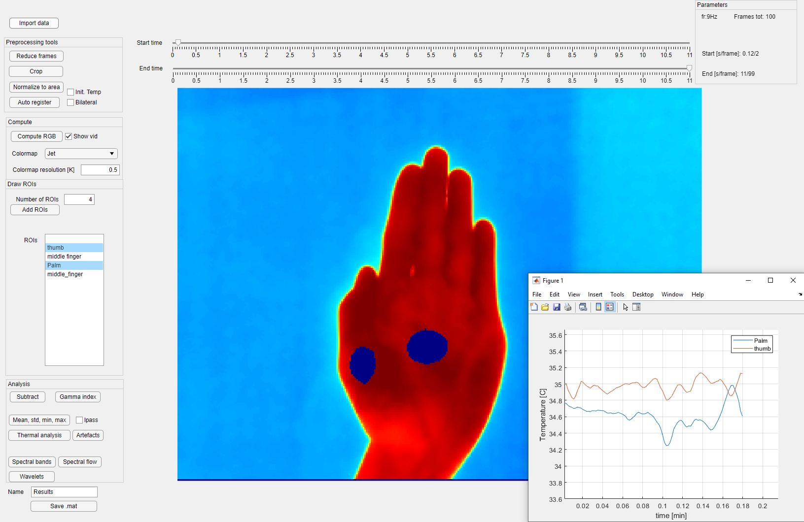GitHub - TPakar/IRlab: IRlab is an open-source project for research purposes in biomedicine ...